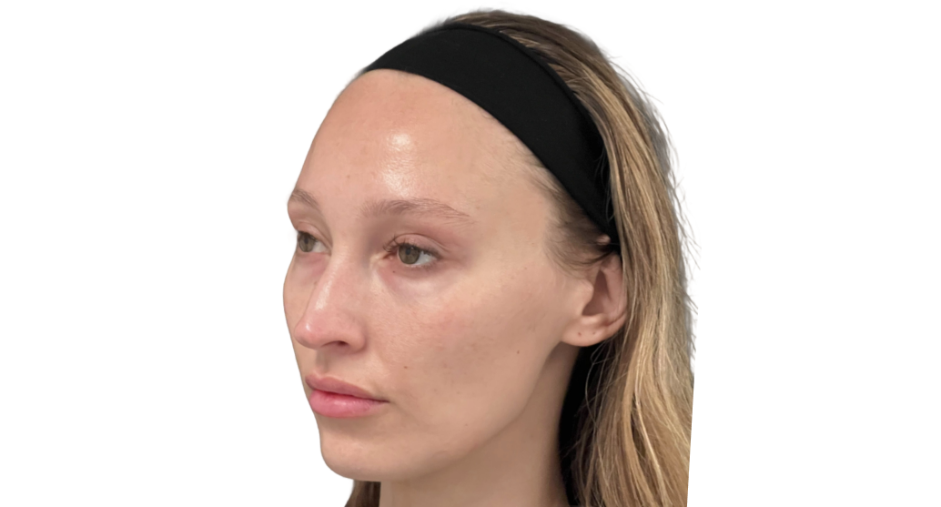 SKORR Glow – SKORR Skincare