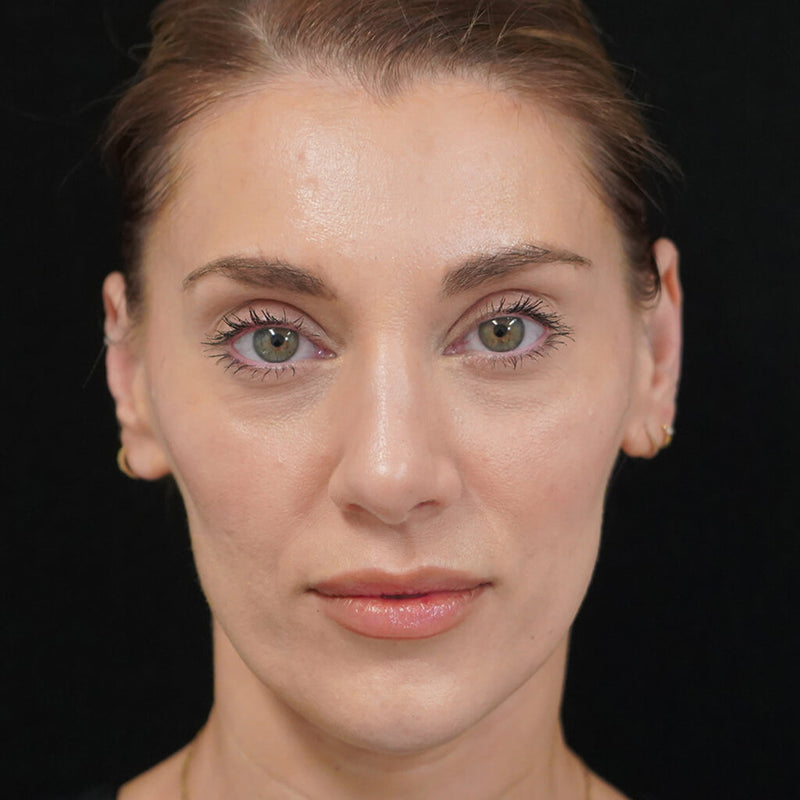 SKORR Glow – SKORR Skincare