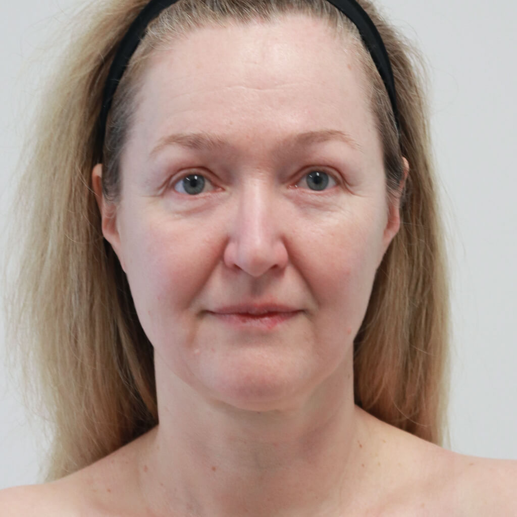 SKORR Glow – SKORR Skincare